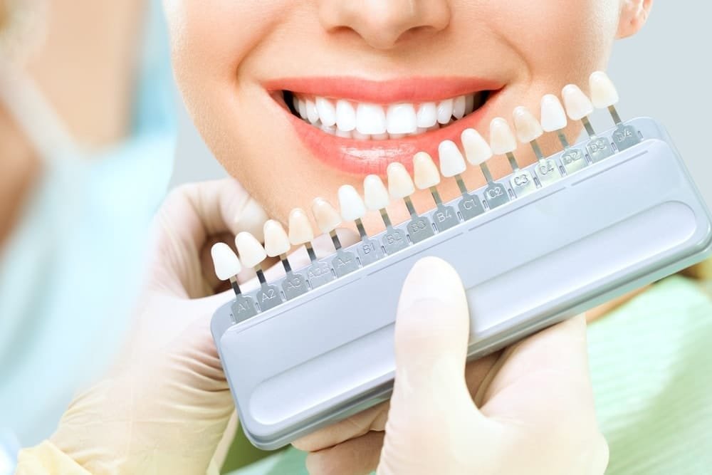 Dental Restoration (Dental Fillings) – Elysian